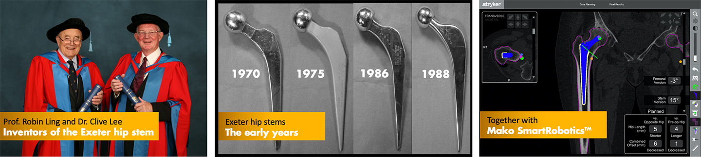 Stryker’s Exeter hip stem turns 50 | Stryker