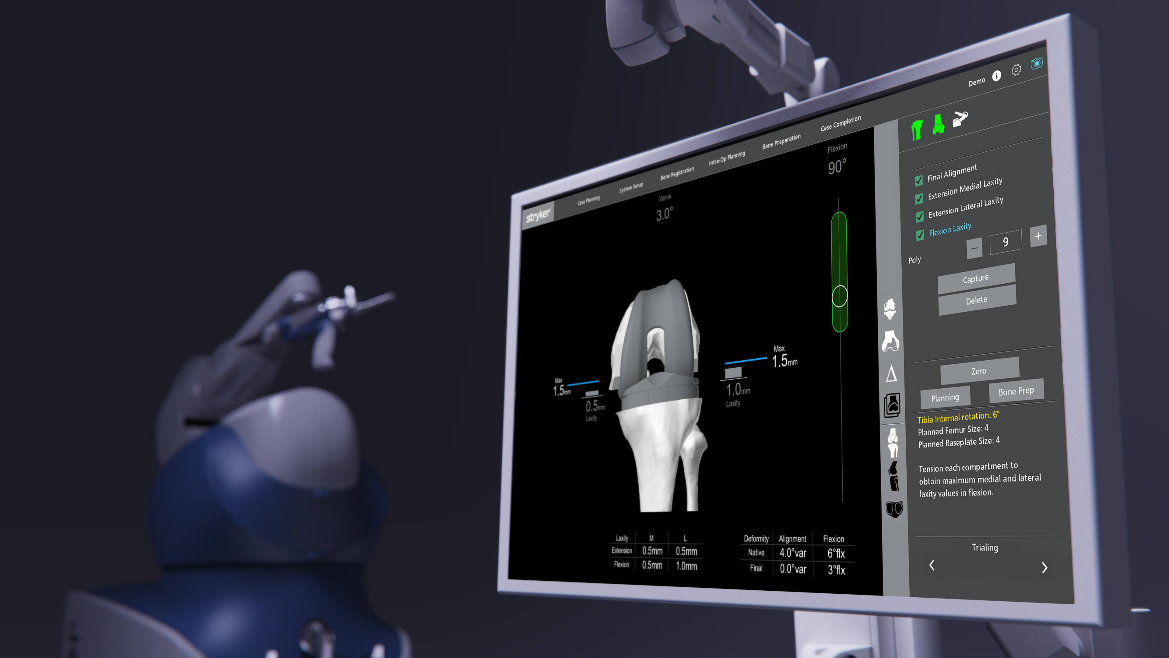Mako: Robotics driving innovation across specialties | Stryker