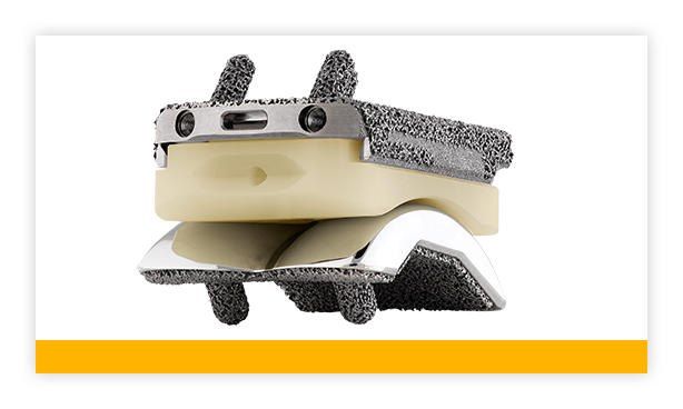 First surgeries using Stryker’s with Adaptis™ and Everlast ...