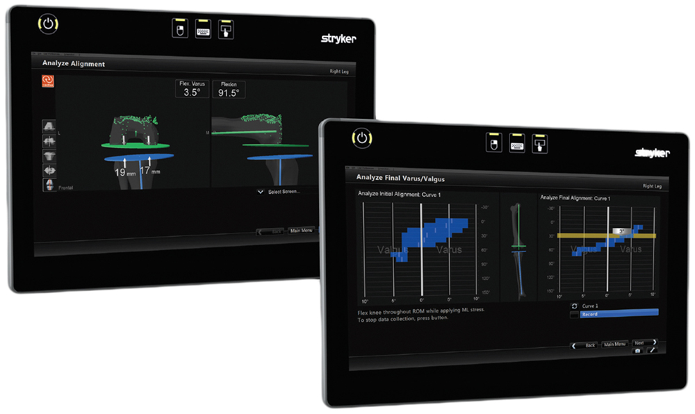 OrthoMap Software | Stryker