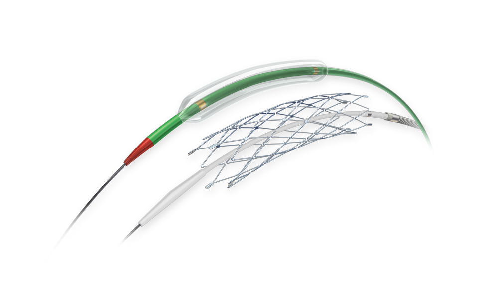 Wingspan Stent System | Stryker