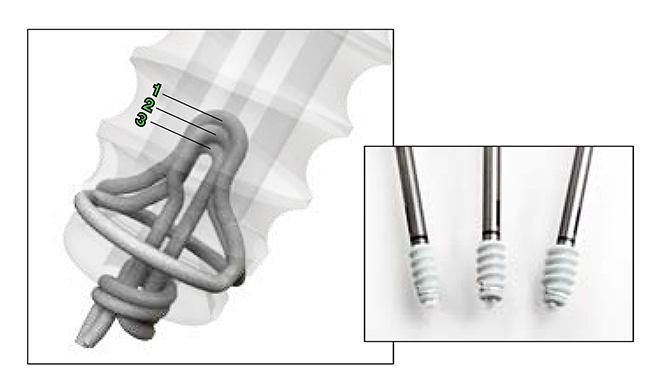 Biosteon IntraLine | Stryker