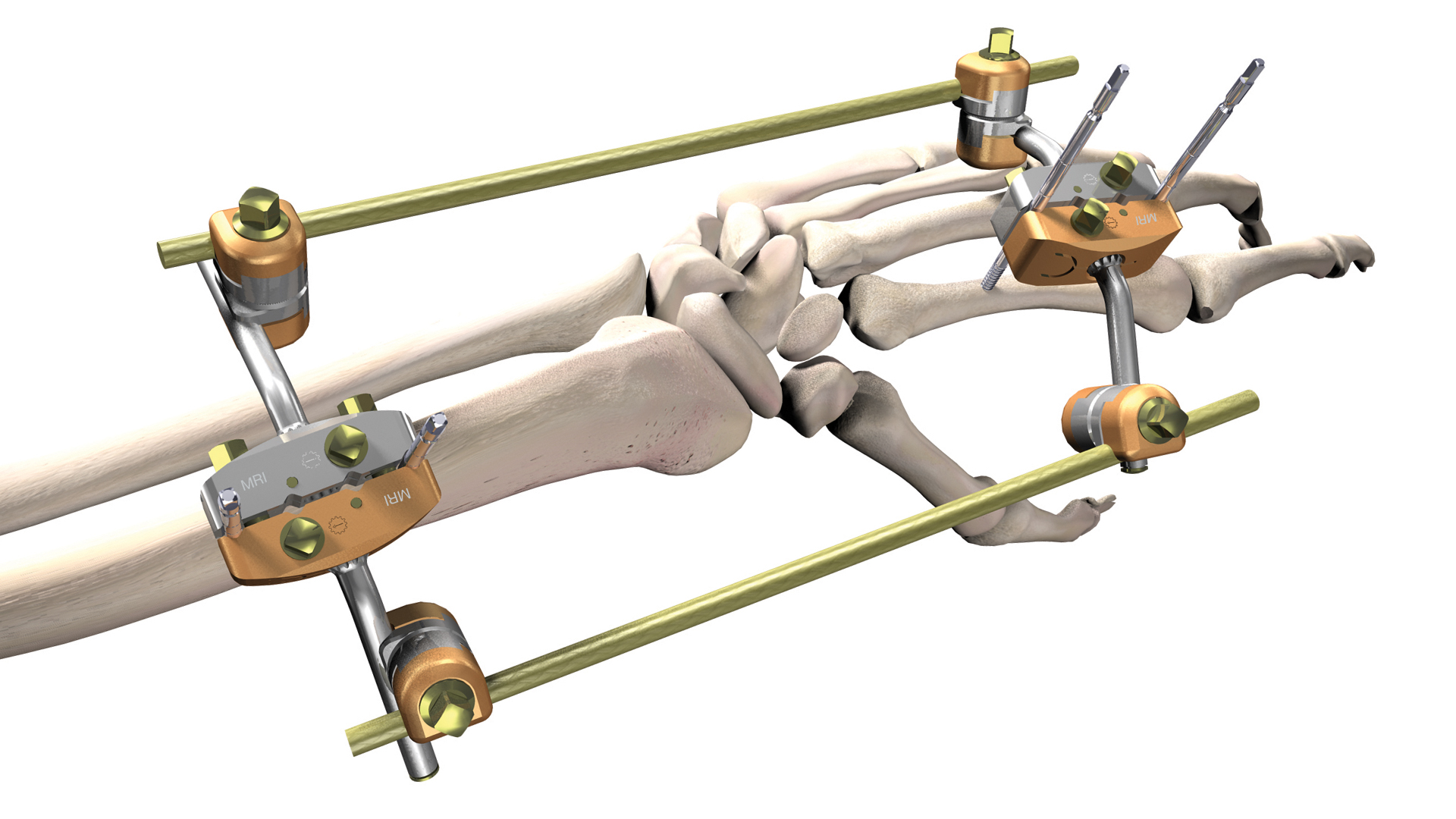 Hoffmann Compact | Stryker