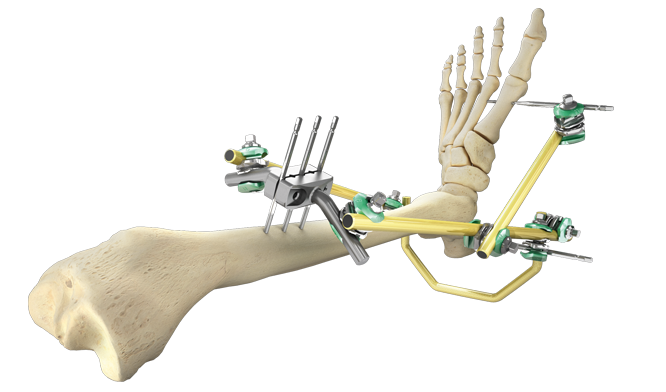 Hoffmann 3 | Stryker