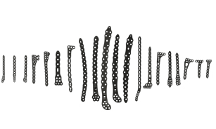 Plating System | Stryker