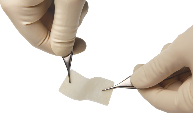 ProLayer Xenograft | Stryker